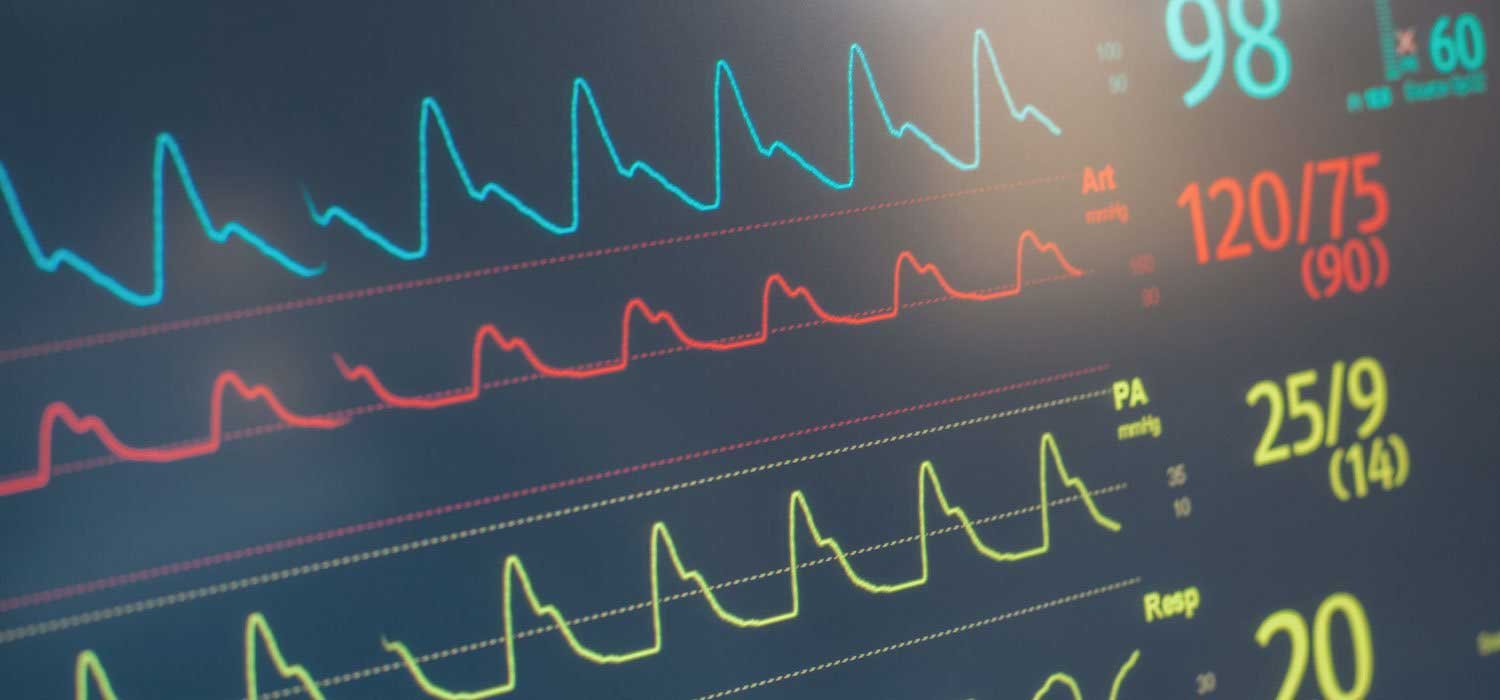 Employee Pulse Survey Strategy: What’s Right For Your Company? | Perceptyx